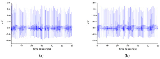 Sleep Apnea Detection Using Wavelet Scattering Transformation and Random Forest Classifier
