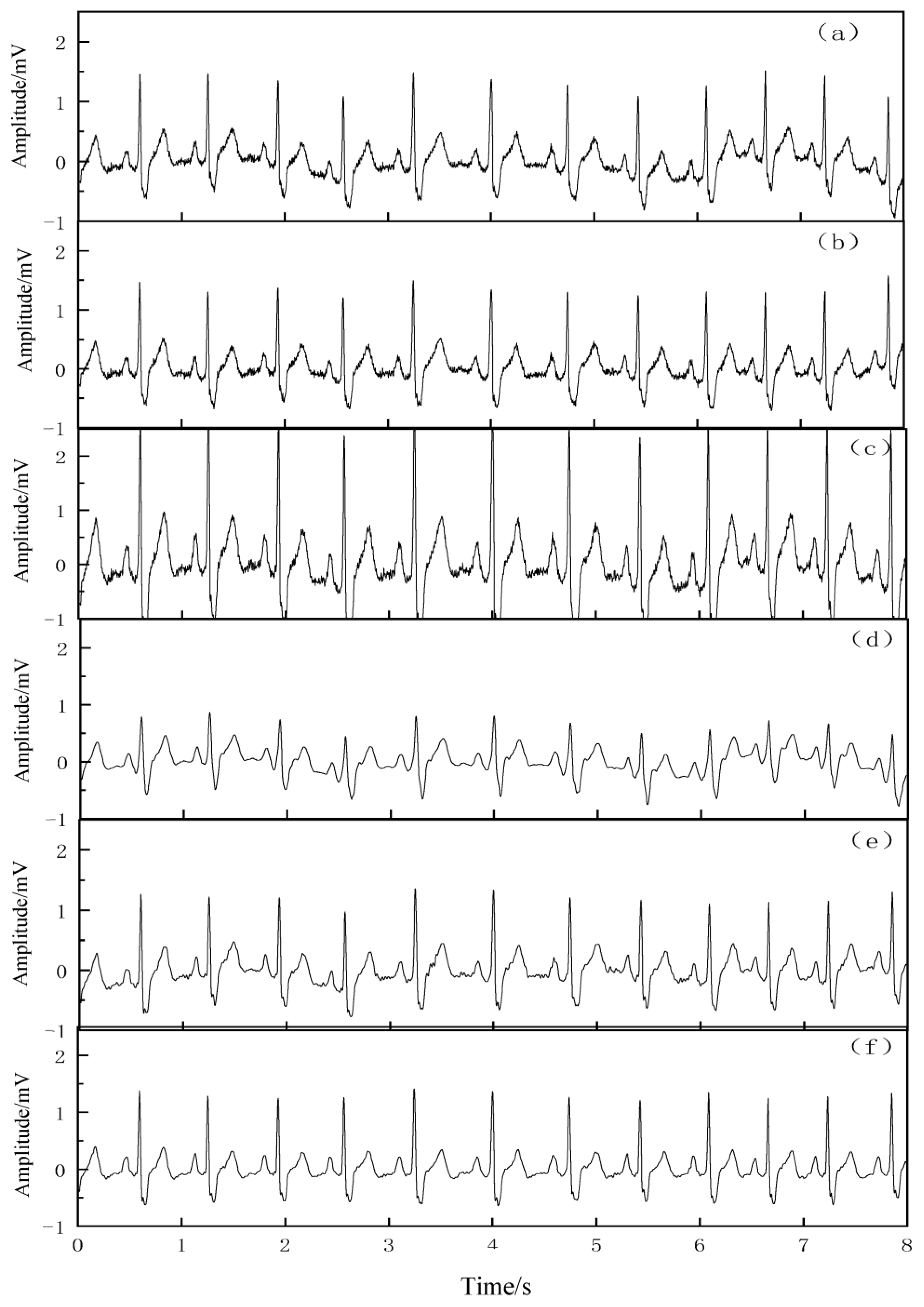 A Novel ECG Signal Denoising Algorithm Based on Sparrow Search ...