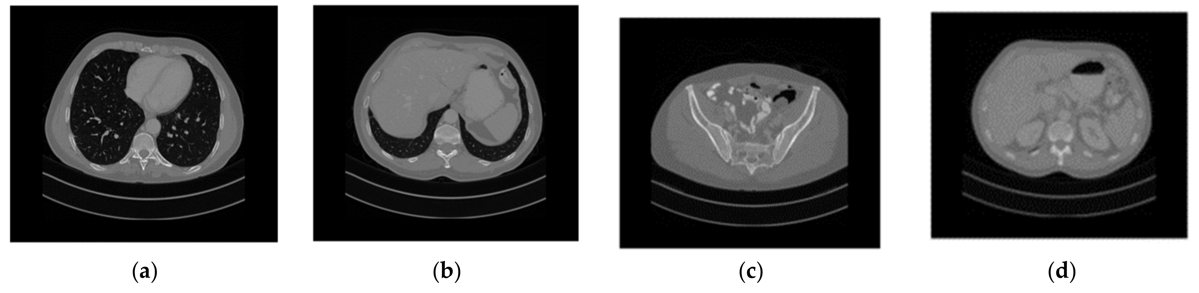 A Multiple-Medical-Image Encryption Method Based on SHA-256 and DNA ...