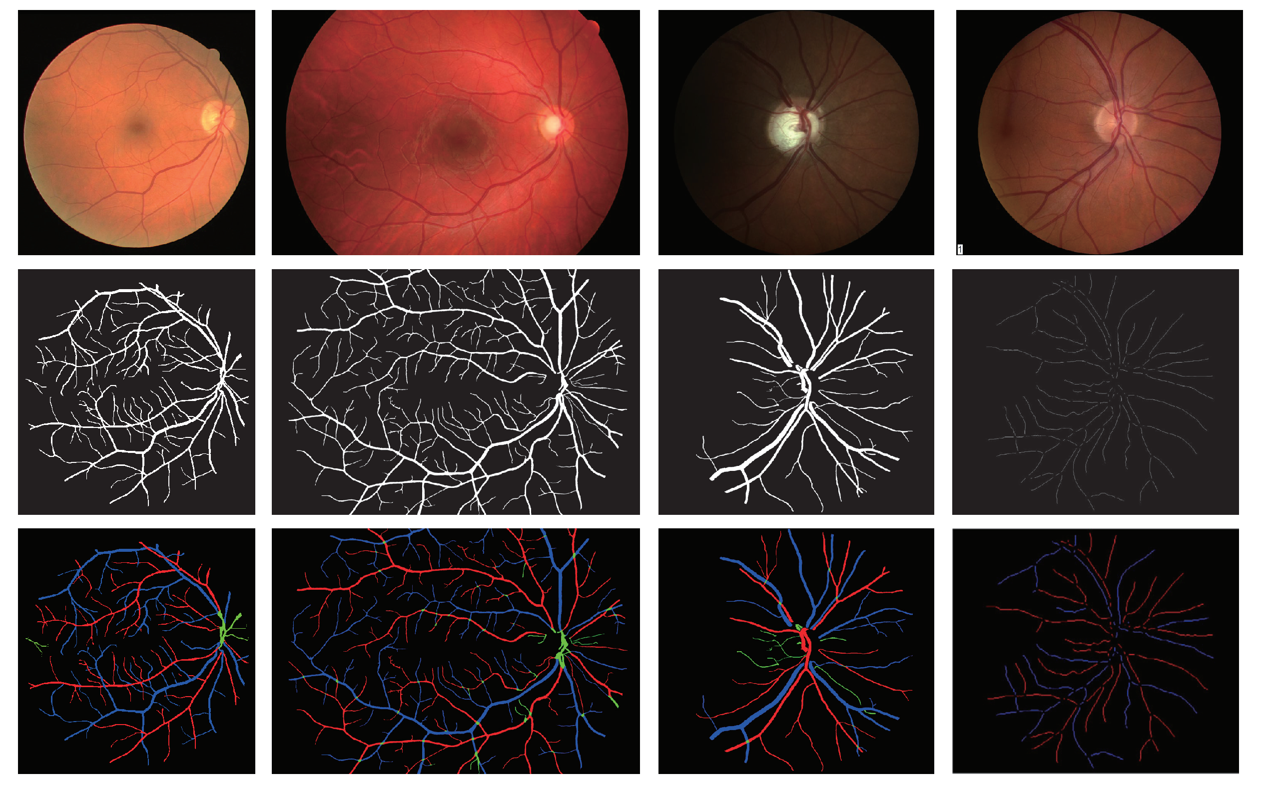 Multi-Task Segmentation and Classification Network for Artery/Vein Classification in Retina Fundus