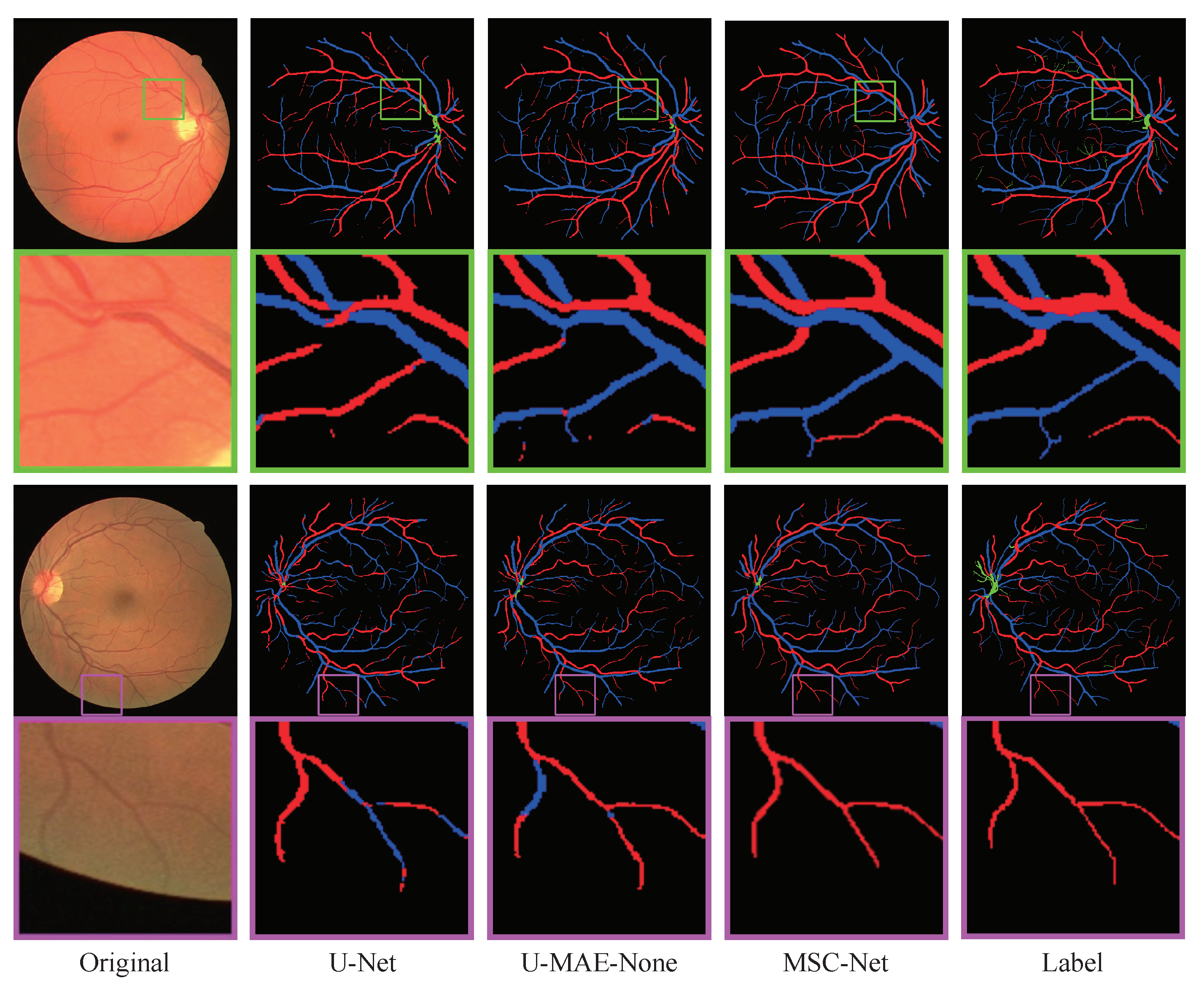 Multi-Task Segmentation and Classification Network for Artery/Vein ...