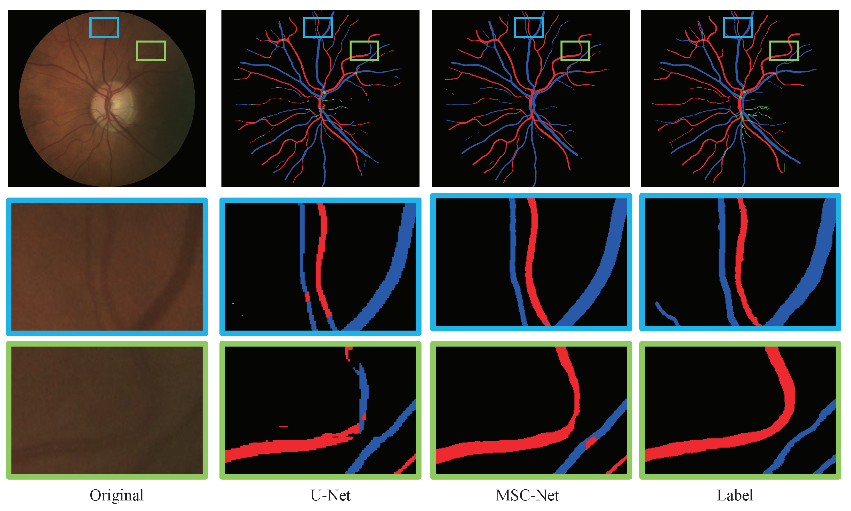 Multi-Task Segmentation and Classification Network for Artery/Vein ...