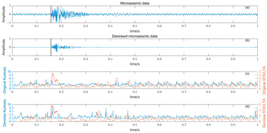 Entropy Free Full Text Automatic P Phase Onset Time Picking Method Of Microseismic