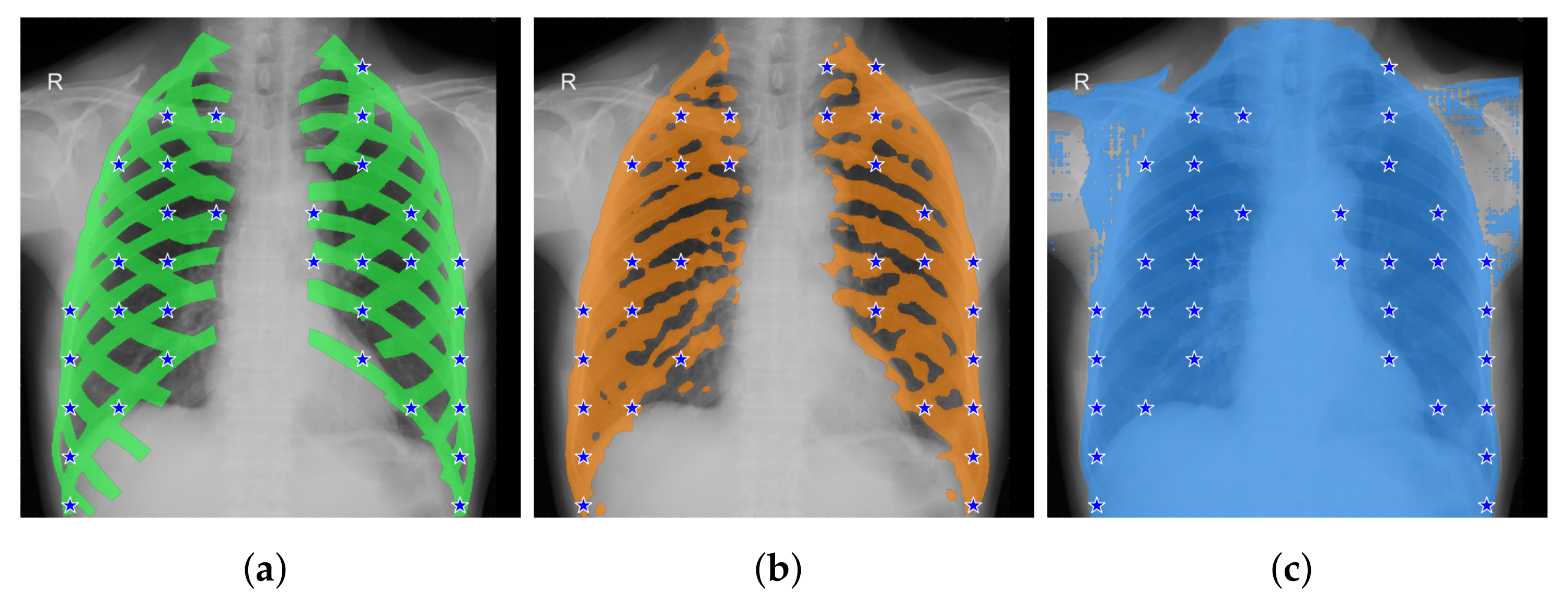 Improving Existing Segmentators Performance with Zero-Shot Segmentators