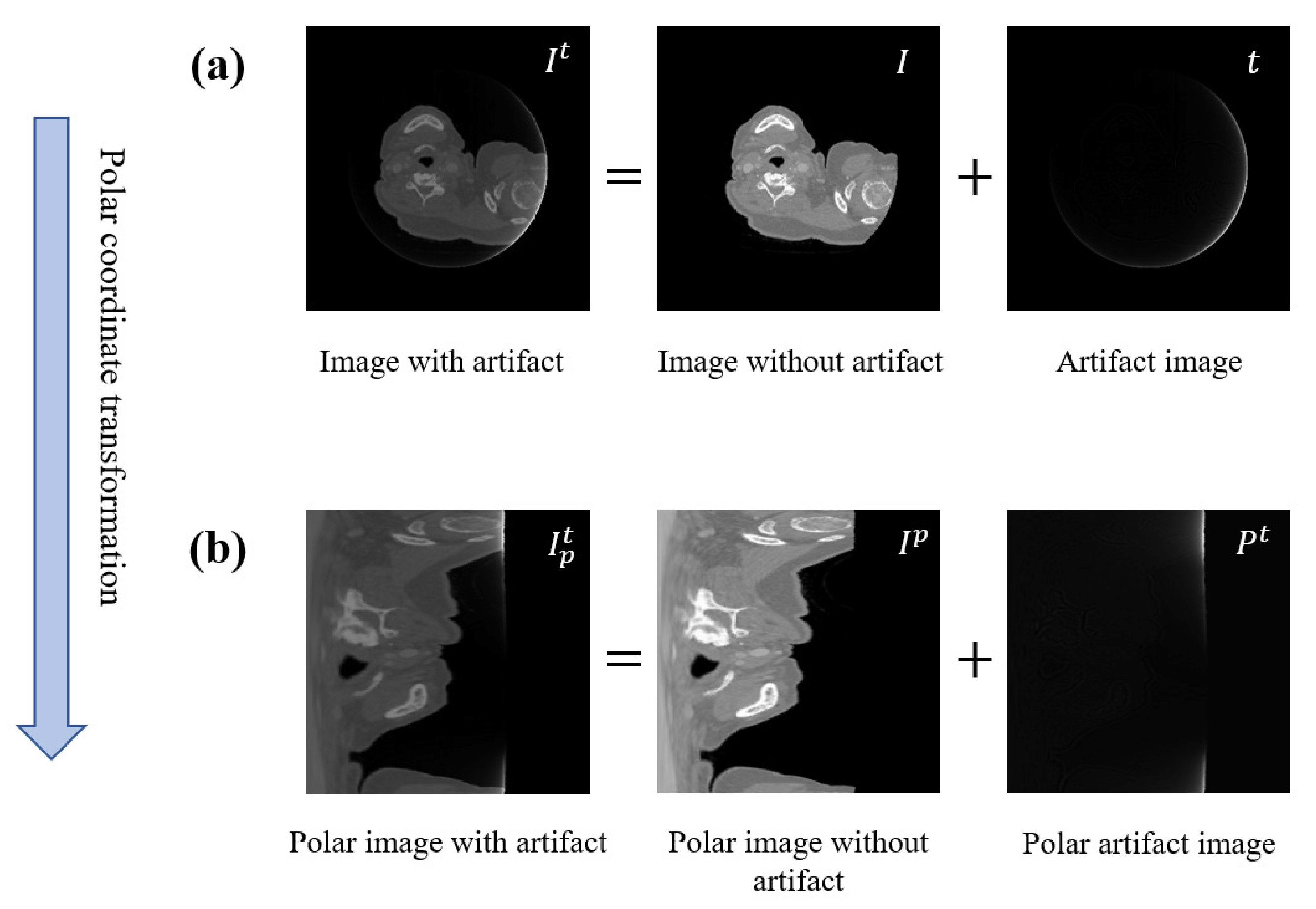 Entropy | Free Full-Text | PIDNET: Polar Transformation Based Implicit ...