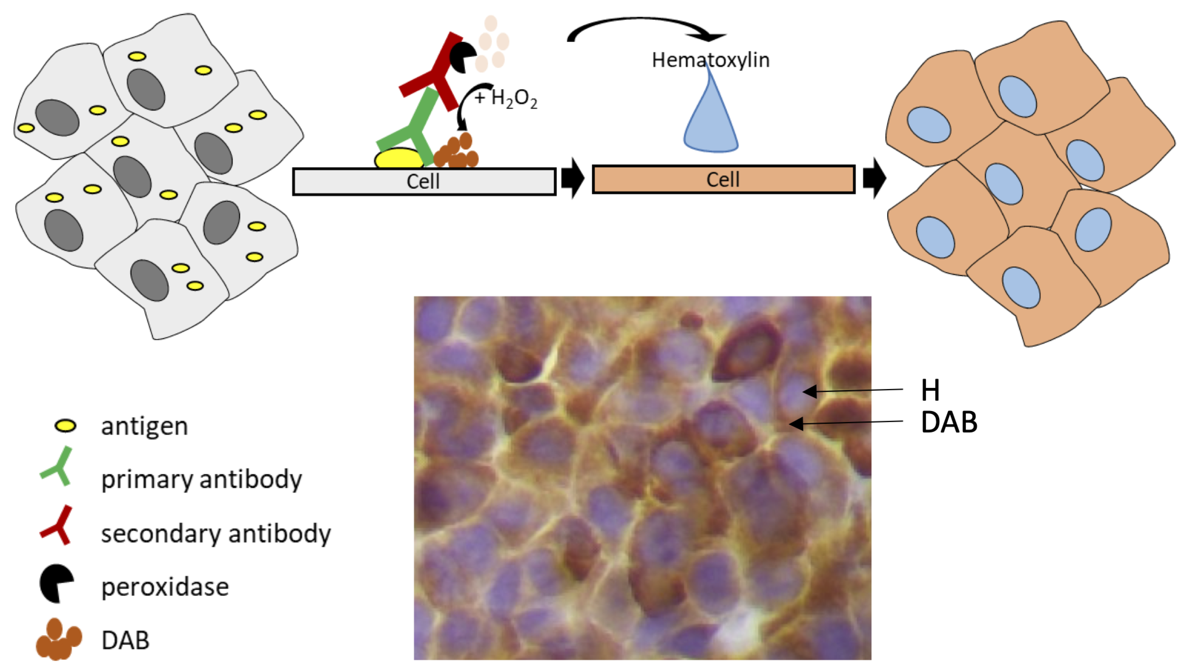 A Robust Method for the Unsupervised Scoring of Immunohistochemical ...