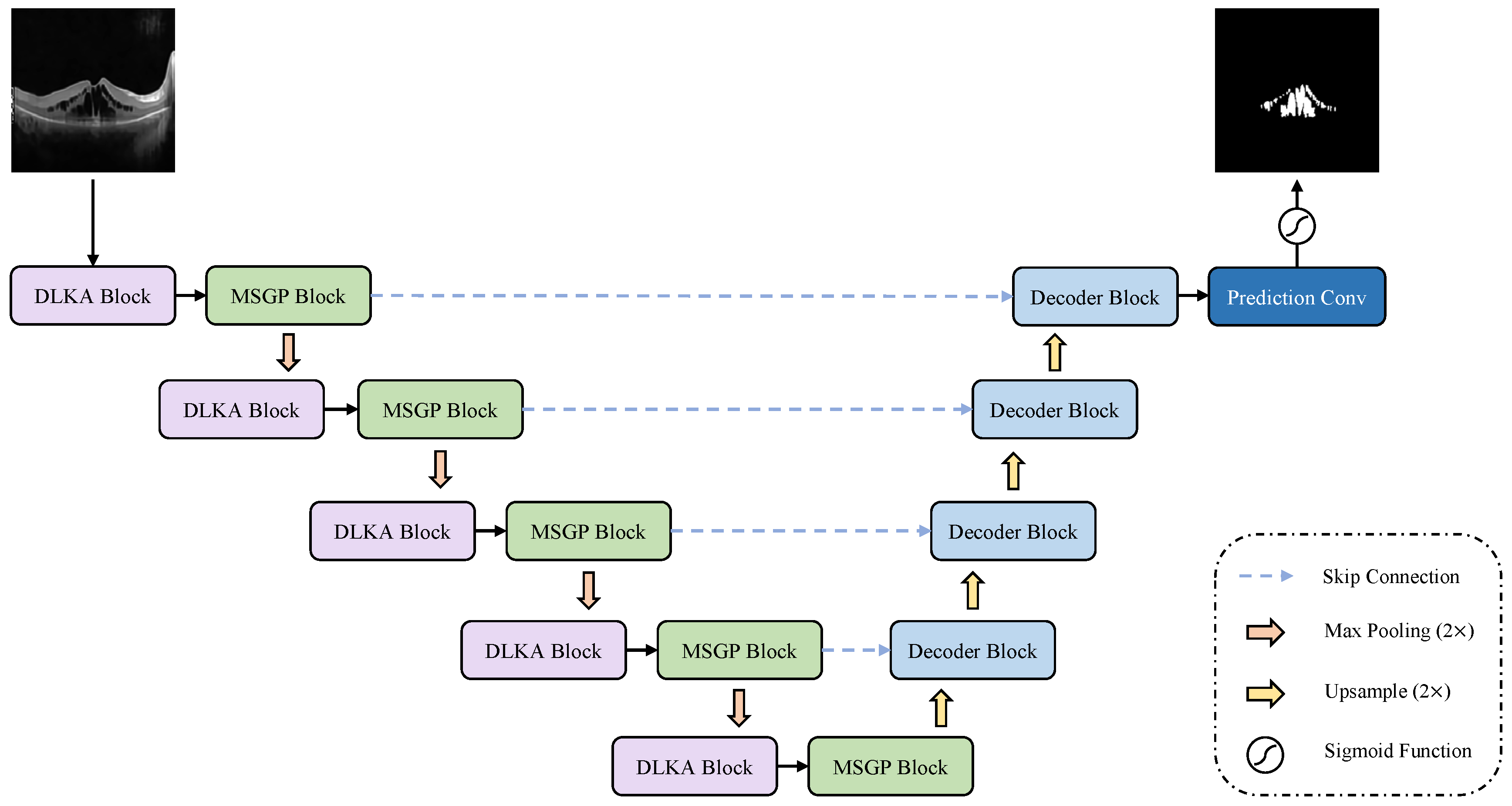 An Efficient Retinal Fluid Segmentation Network Based on Large Receptive Field Context Capture ...