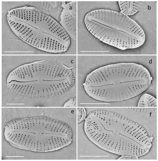 Environments | Free Full-Text | Diatom Deformities and Tolerance to ...