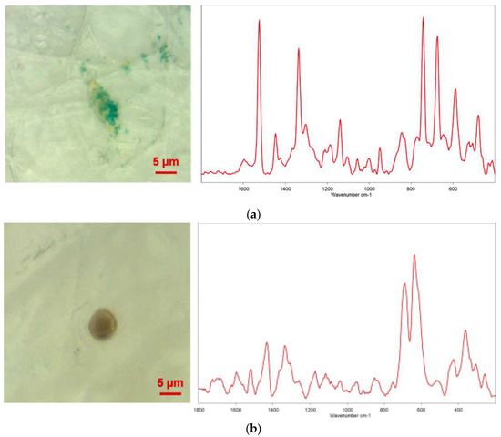 The Plastic Within: Microplastics Invading Human Organs and Bodily ...