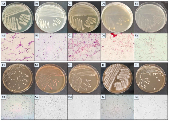 Bacteria and Yeasts Isolated from the Environment in Biodegradation of ...