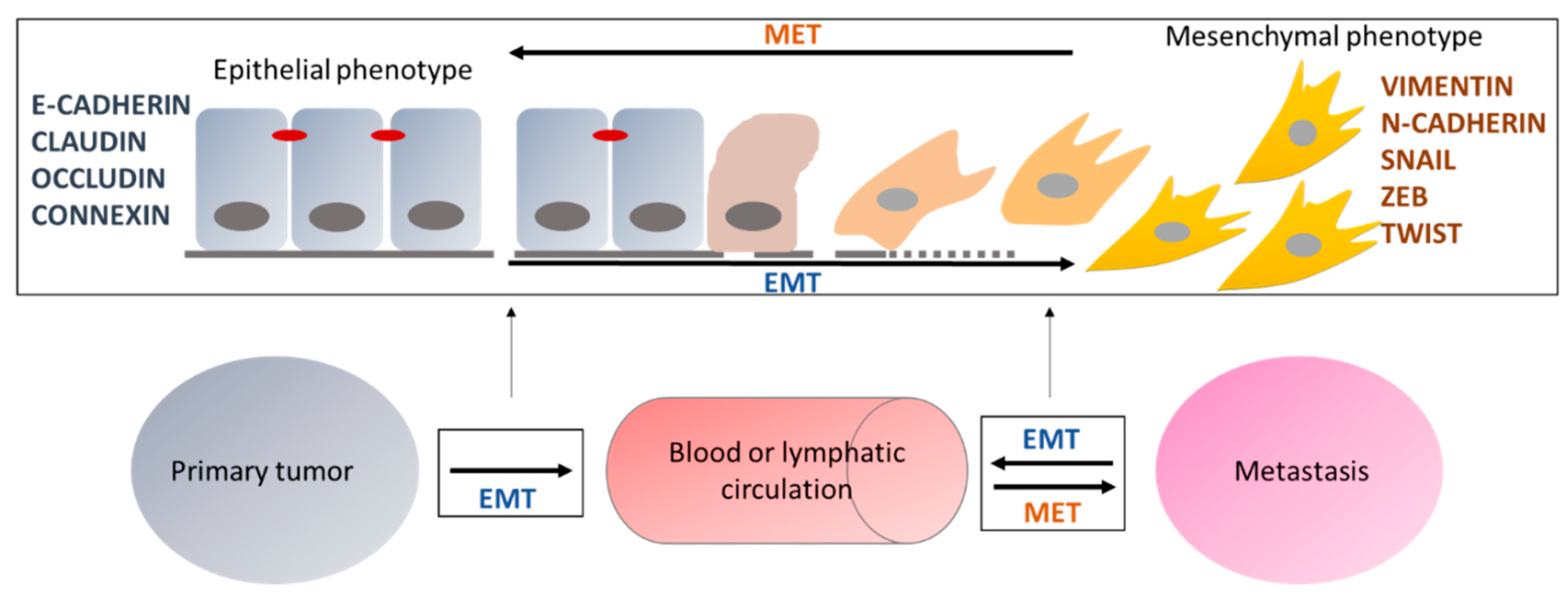 Epigenetic Regulation of EMT (Epithelial to Mesenchymal Transition) and Tumor Aggressiveness: A ...