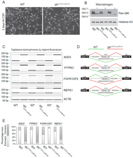 Targeting the RNA-Binding Protein QKI in Myeloid Cells Ameliorates ...
