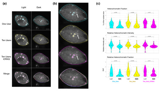 Advanced Image Analysis Methods for Automated Segmentation of Subnuclear Chromatin Domains