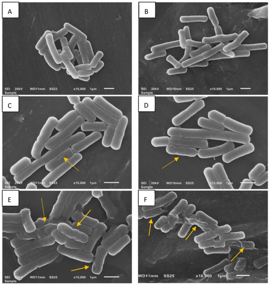 The Biological Role of the S-Layer Produced by Lactobacillus helveticus ...