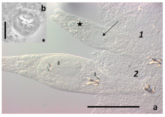 Transmission Strategies Used by Gyrodactylus gasterostei (Monogenea) on ...