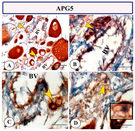 Immune Cell Profiling in the Ovarian Stroma of a Viviparous Fish during ...
