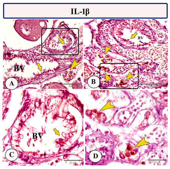Immune Cell Profiling in the Ovarian Stroma of a Viviparous Fish during ...