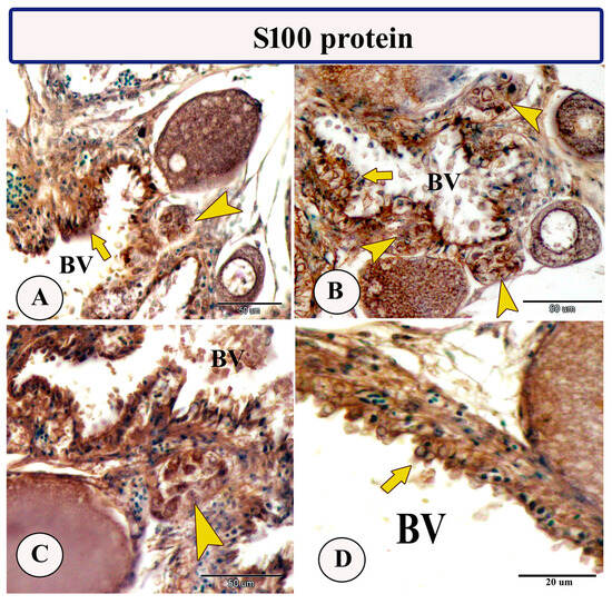 Immune Cell Profiling in the Ovarian Stroma of a Viviparous Fish during ...