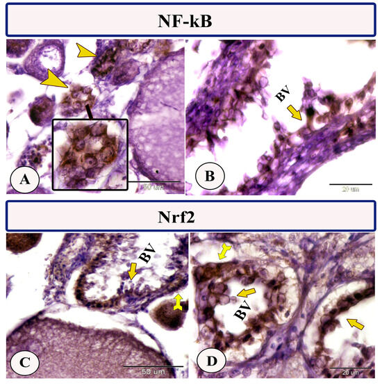 Immune Cell Profiling in the Ovarian Stroma of a Viviparous Fish during ...