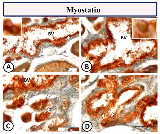 Immune Cell Profiling in the Ovarian Stroma of a Viviparous Fish during ...