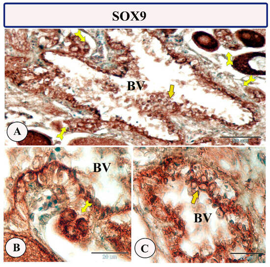 Immune Cell Profiling in the Ovarian Stroma of a Viviparous Fish during ...