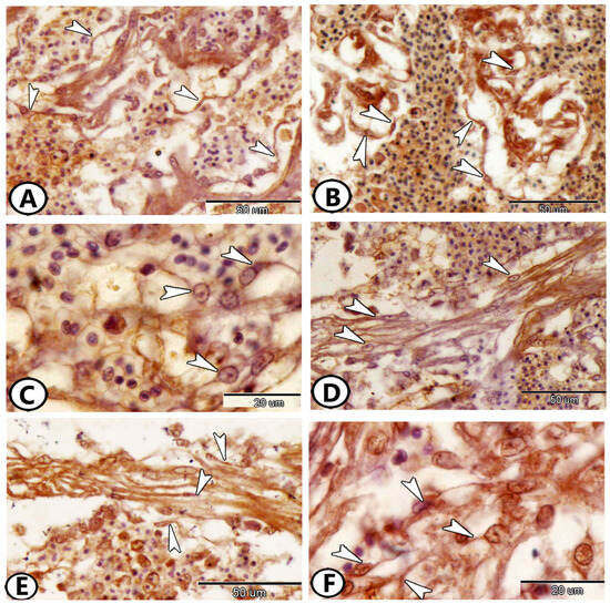 From Proliferation to Protection: Immunohistochemical Profiling of ...
