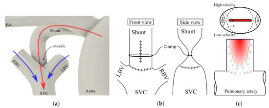 Characterization of the Ejector Pump Performance for the Assisted ...