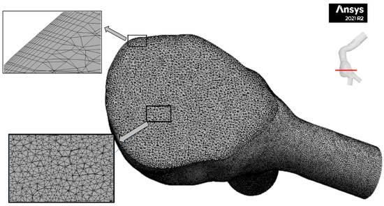 Fluids | Special Issue : Image-Based Computational and Experimental Biomedical Flows