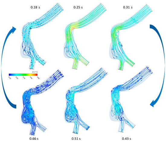 Fluids | Special Issue : Image-Based Computational and Experimental Biomedical Flows