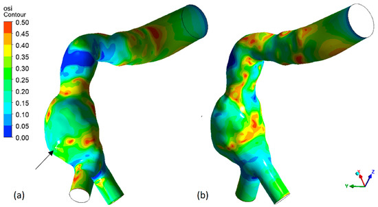 Fluids | Special Issue : Image-Based Computational and Experimental Biomedical Flows