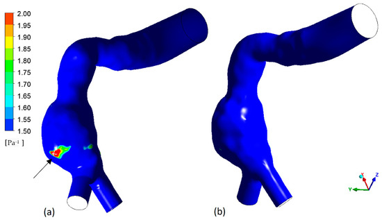 Fluids | Special Issue : Image-Based Computational and Experimental Biomedical Flows