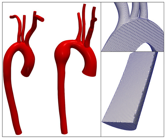 Blood Flow Simulation of Aneurysmatic and Sane Thoracic Aorta Using OpenFOAM CFD Software