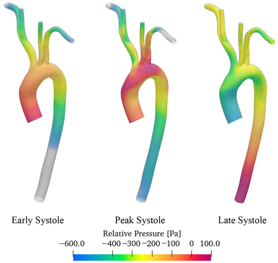 Blood Flow Simulation of Aneurysmatic and Sane Thoracic Aorta Using OpenFOAM CFD Software