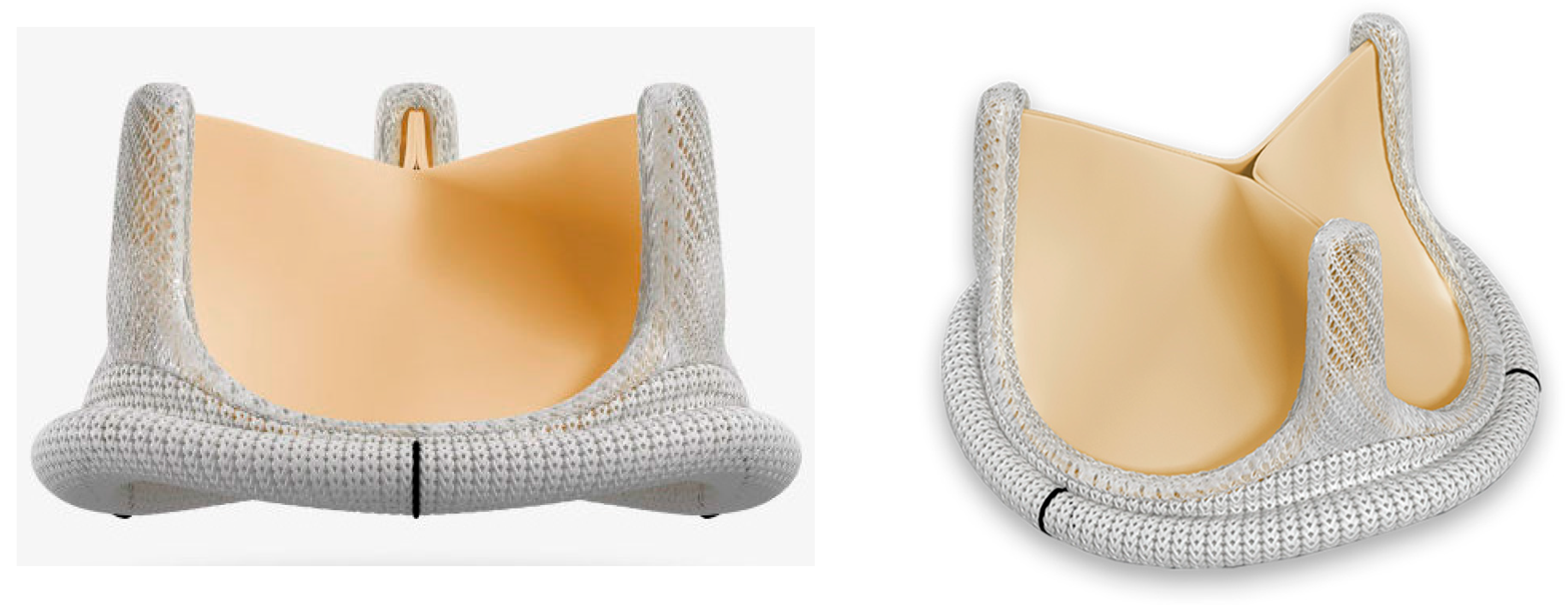 Fluids | Free Full-Text | Fluid–Structure Interaction Aortic Valve Surgery Simulation: A Review