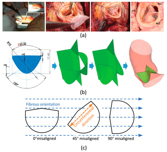 Fluid–Structure Interaction Aortic Valve Surgery Simulation: A Review