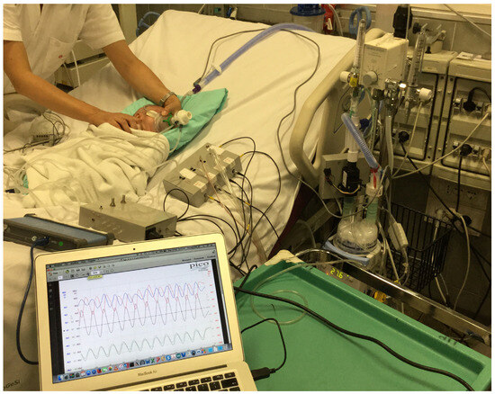 Real-Time Optimal Flow Setting and Respiratory Profile Evaluation in ...