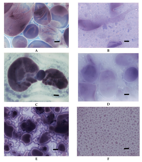 Light Microscopy as a Tool to Evaluate the Functionality of Starch in Food