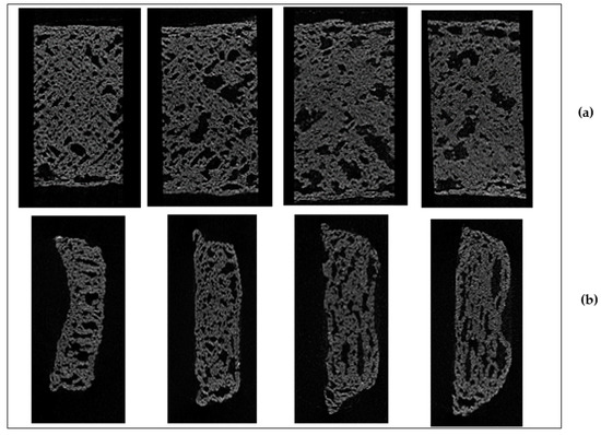 Influence of Selected Product and Process Parameters on Microstructure ...