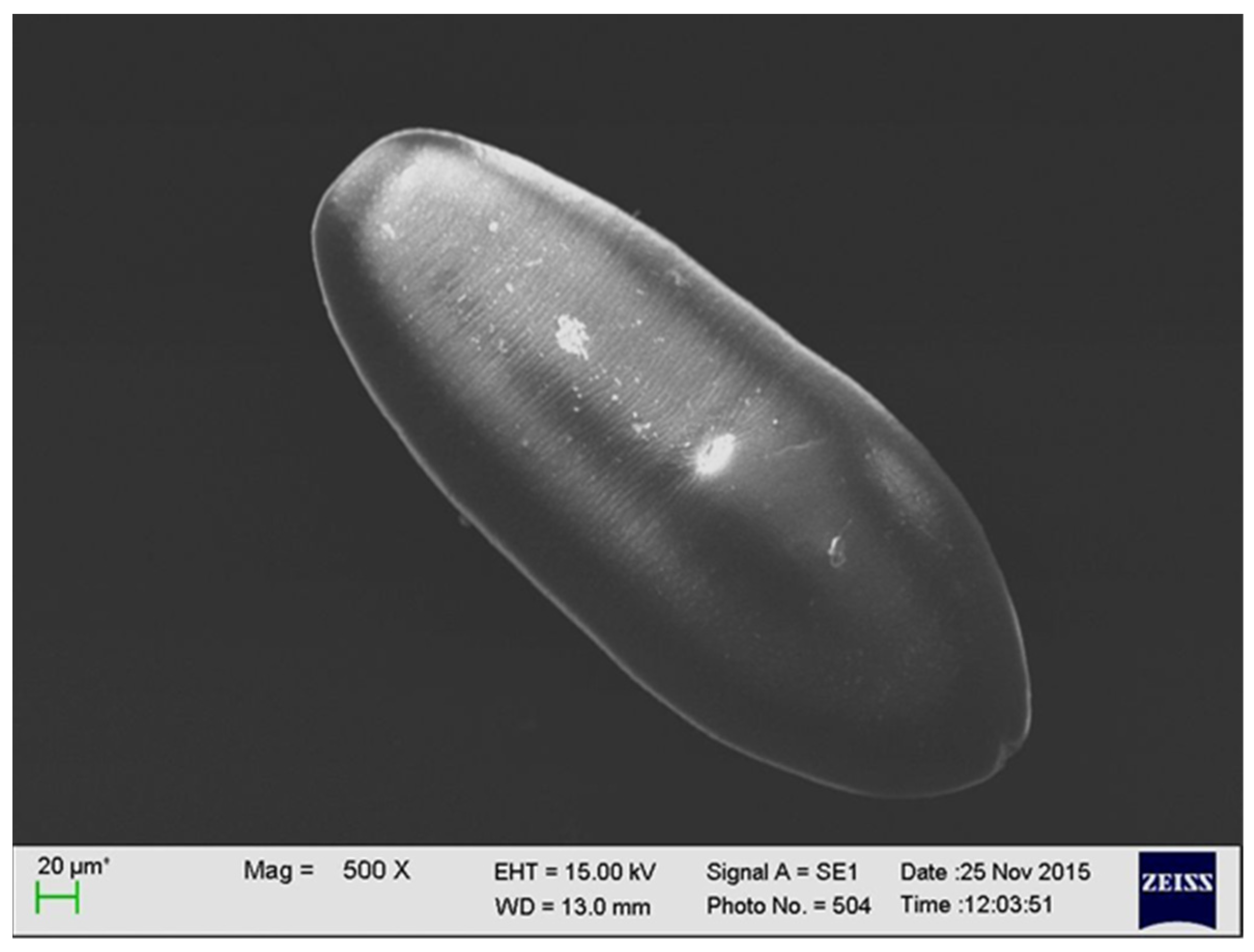 Alaria alata in Terms of Risks to Consumers’ Health