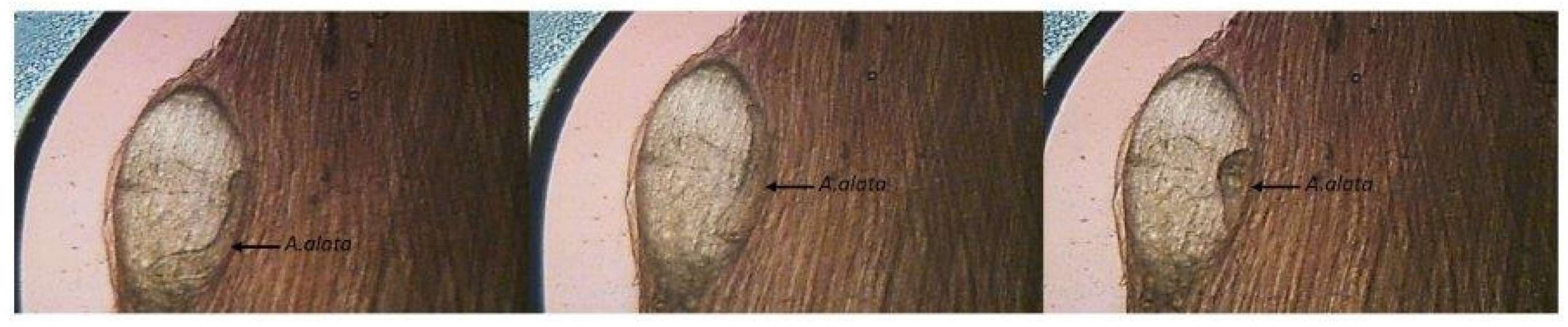 Alaria alata in Terms of Risks to Consumers’ Health