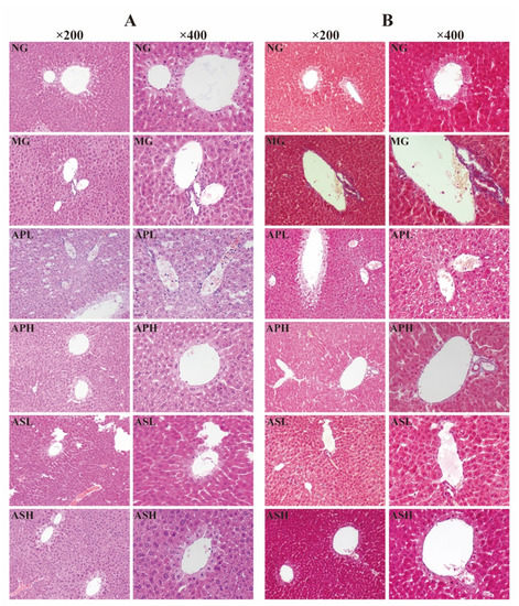 Astragalus Polysaccharides and Saponins Alleviate Liver Injury and ...