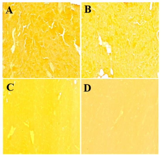 The Texture Change of Chinese Traditional Pig Trotter with Soy Sauce ...