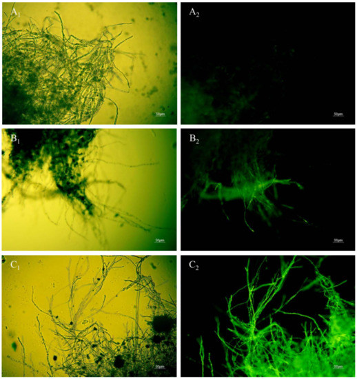 Inhibitory Effect of Polypeptides Produced by Brevibacillus brevis on ...