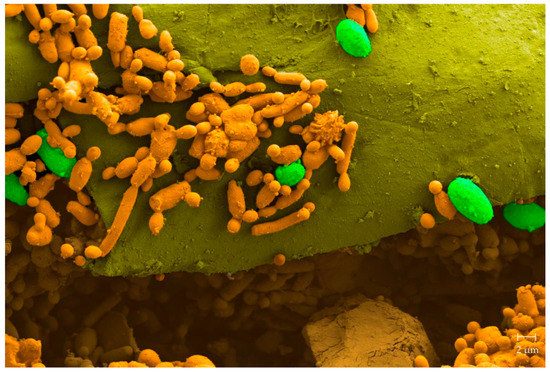 Emerging Postharvest Technologies to Enhance the Shelf-Life of Fruit ...