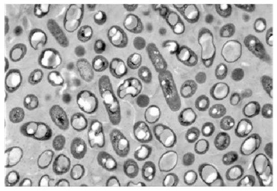Recent Progress in Microencapsulation of Active Peptides—Wall Material ...