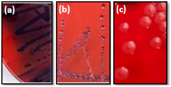 Detection of Methicillin-Resistant Staphylococcus aureus among ...