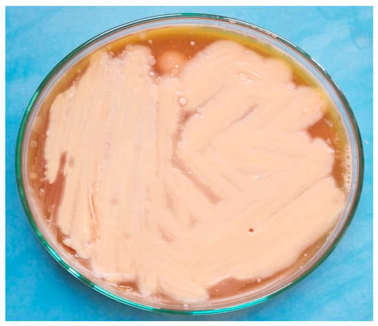 Detection of Clostridium botulinum in Some Egyptian Fish Products, Its ...