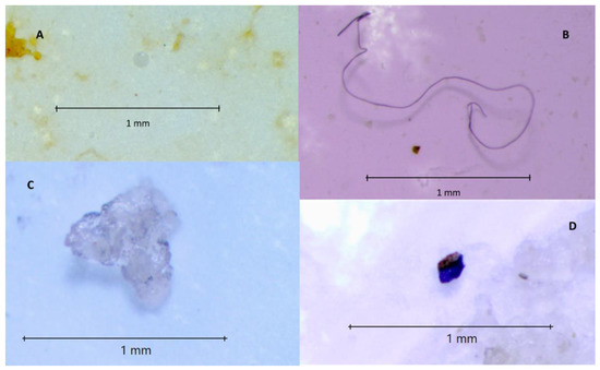 Occurrence and Characterization of Microplastics in Commercial Mussels (Mytilus ...
