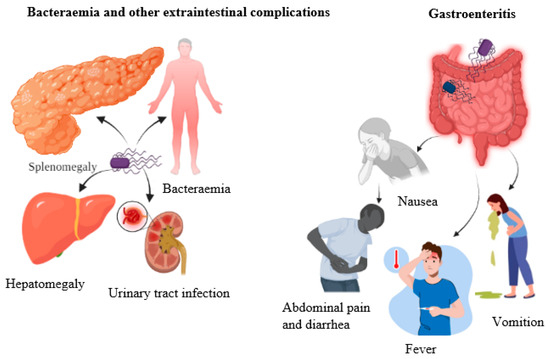 Foods | Free Full-Text | Human Salmonellosis: A Continuous Global ...