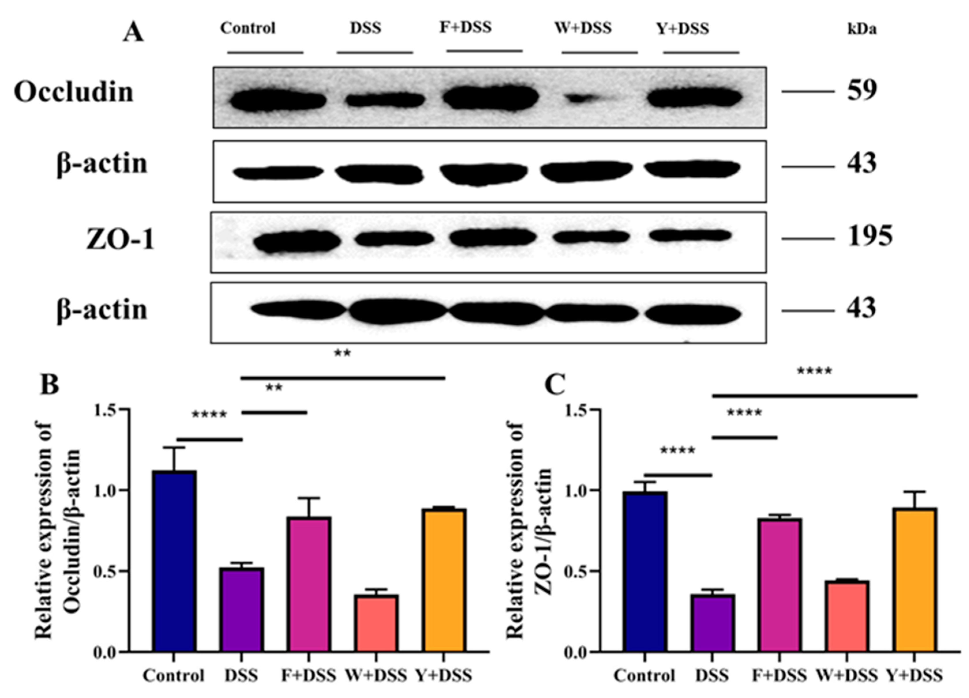 Fermented Sargassum fusiforme Mitigates Ulcerative Colitis in Mice by ...
